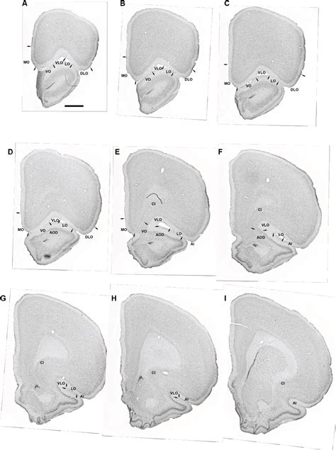 Figure 8 From Projections Of The Posterior Parietal Cortex To The