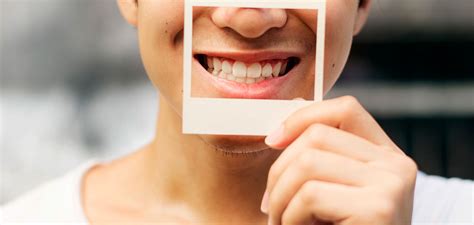 Our Services Nourish Dental Sleep And Tmj Care