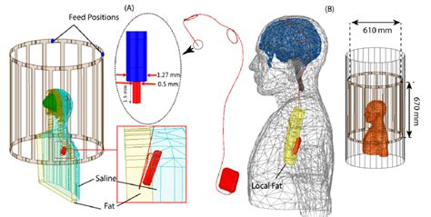 Simulation Setups With Experiment Mimicking Phantom Model A And