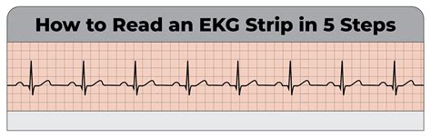 How To Read An Ekg Strip In 5 Steps Cardiacdirect