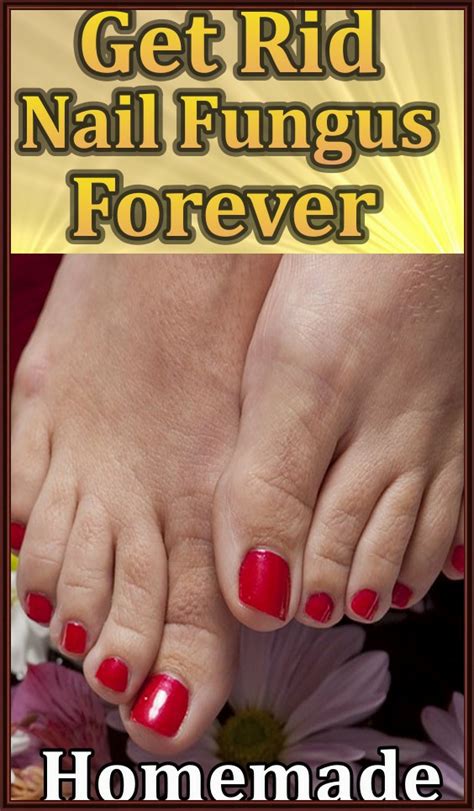 Get Rid Of Nail Fungus Forever 2 Ingredient Recipe