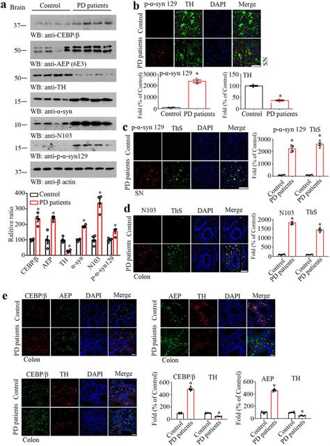 C Ebpβ Aep Signaling Is Upregulated In Pd Patient Brain And Gut A