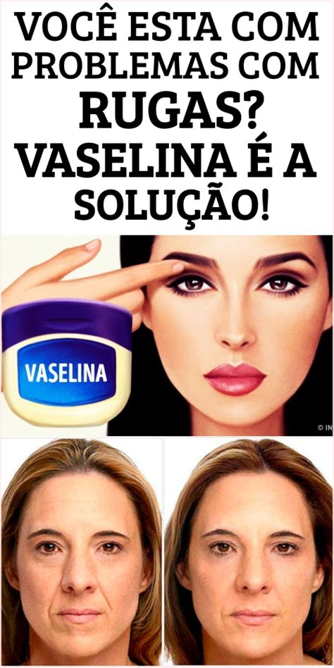 Receita Com Vaselina Para Eliminar Rugas No Rosto Passo A Passo