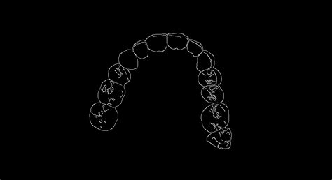 python return position and size of arbitrary teeth shapes in image