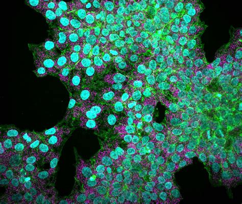 Single Cell Biology Pelkmanslab
