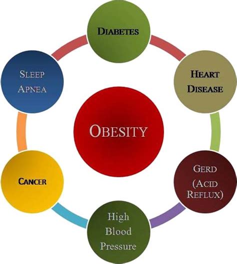 Causes Of Obesity