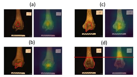 sex estimation from photographs of the ilium and humerus using deep