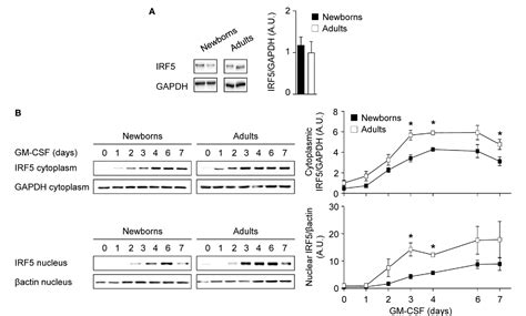 Figure 1 From Irf5 Is A Key Regulator Of Macrophage Response To