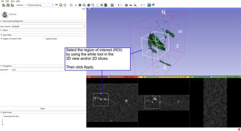 documentation nightly modules astromasking slicer wiki