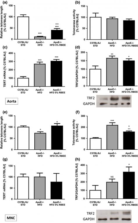 Telomere Length Telomerase Activity And Trf2 Expression In Aorta And