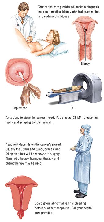 Uterine Endometrial Cancer Spectrum Health