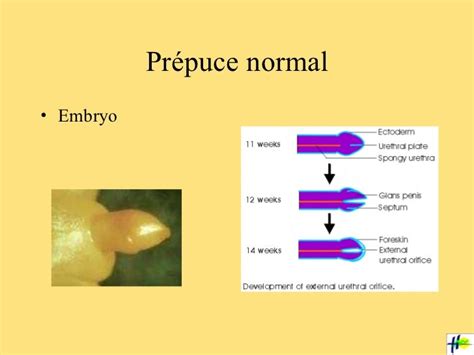Urogyn Pedia 2 Rm 12 04 11
