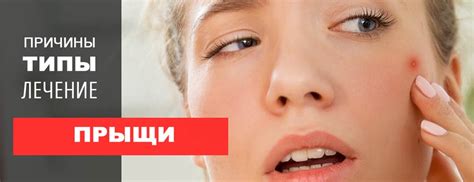 Прыщи на лице симптомы причины и лечение в домашних условиях