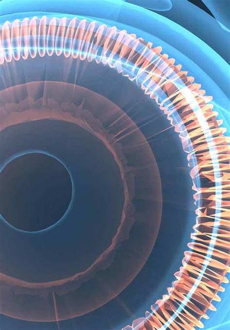 Combined Glaucoma And Cataract An Overview Intechopen