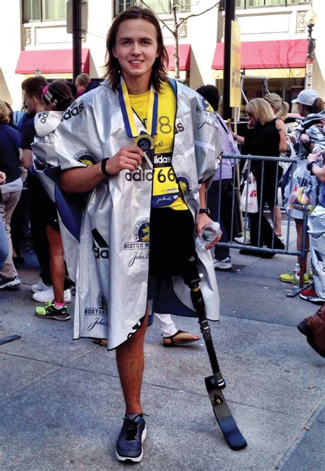Veteran Amputee Gets Leg Up With Breakthrough Prosthesis Article
