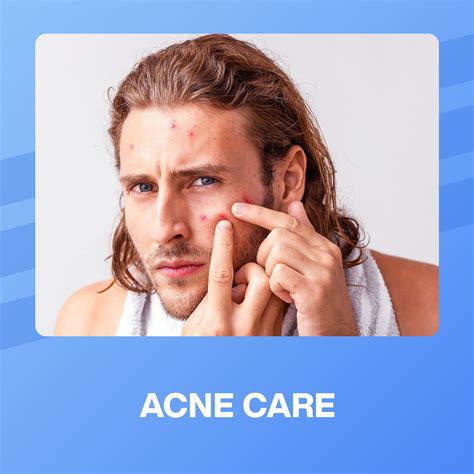 4 Easy And Effective Remedies For Oily And Acne Prone Skin Artofit