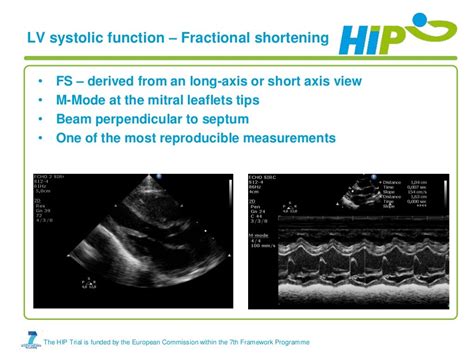 Functional Echocardiography Targeted Neonatal Echocardiography Tne …