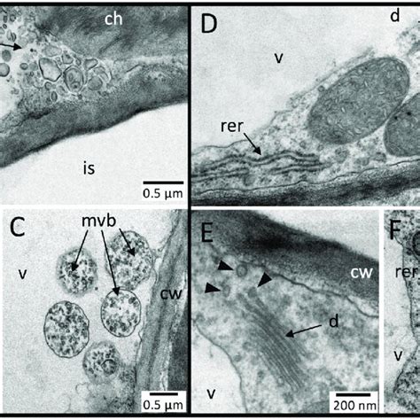 Contrast In The Cell Wall Thickening Processes At The 3 Rd A C Vs 10