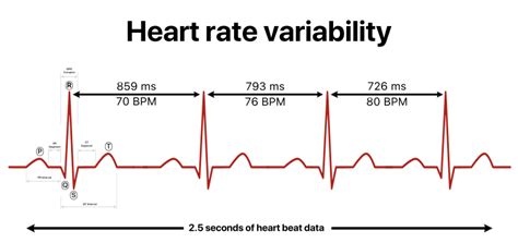 What Is Heart Rate Variability Soma Haus