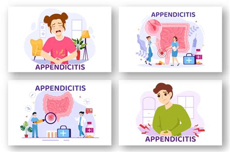 12 Appendicitis Inflammation Illustration
