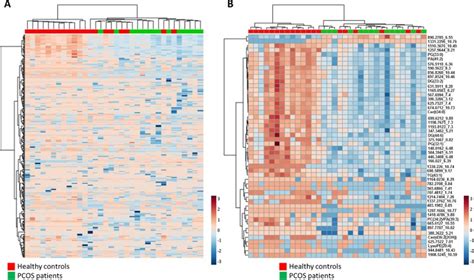 lipidomics reveals altered biosynthetic pathways of
