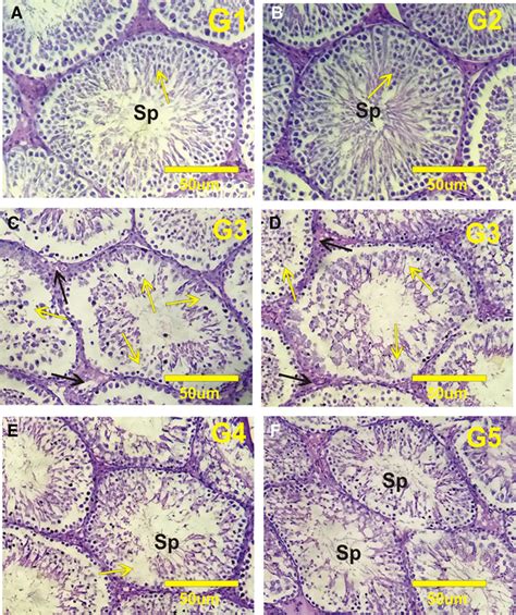 Photomicrograph Of Rats Testicular Tissues Of Different Experimental