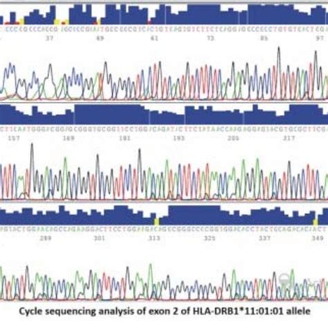 Cycle Sequencing Analysis Of Exon 2 Of Hla Drb1 11 01 01 Allele