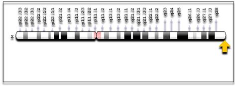 The F8 Gene The F8 Gene Location On The Chromosome Xq28 From