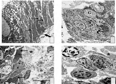 Electron Micrographs For Ultrathin Sections Group Iii Showing Electron