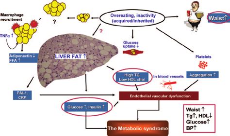 A Schematic Representation Of How Components Of The Metabolic Syndrome