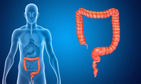 Cancer Du Côlon Ou Du Rectum La Différence