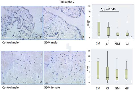 Ijms Free Full Text Cell Type And Sex Specific Dysregulation Of