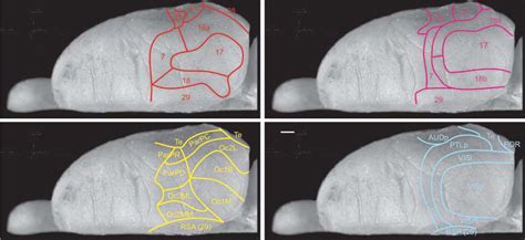 Posterior Parietal Cortex