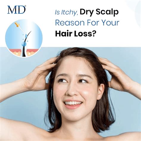 Common Causes Of Female Hair Loss Symptoms And How To Stop It Md®