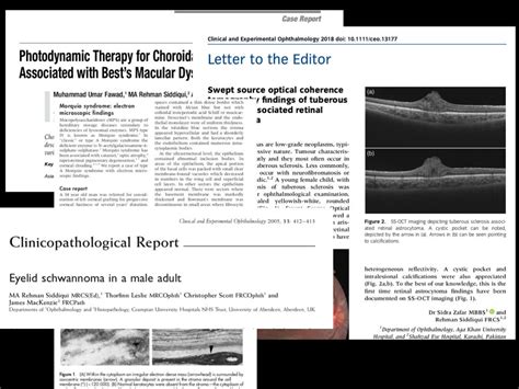 Ophthalmology Journals For Case Reports By Rehman Siddiqui Medium