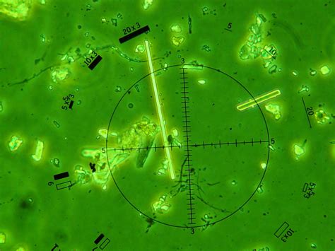fiberglass and chrysotile pcm sample image showing microscop… flickr