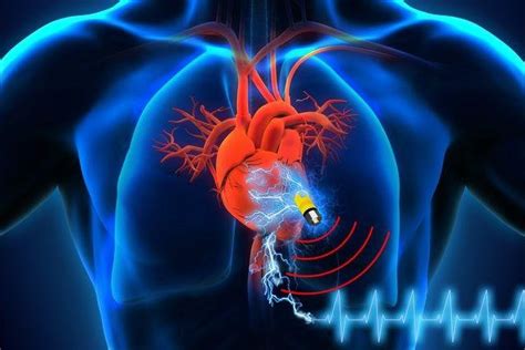 battery less medical implant turns human body s ions into storable