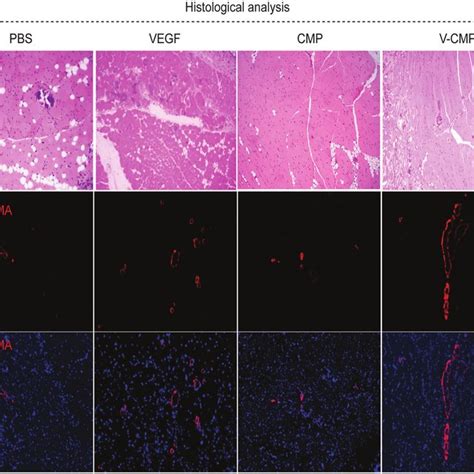 Histological And Immunostaining Analysis Of The Ischemia Tissues