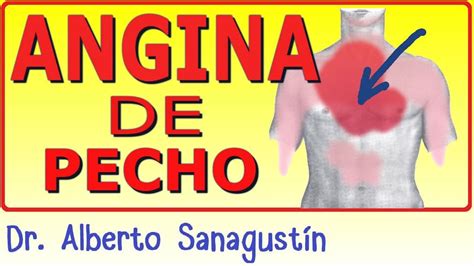 Paso A Paso Sobre Dolor De Pecho Por Ansiedad Todo Tiene Un Porque