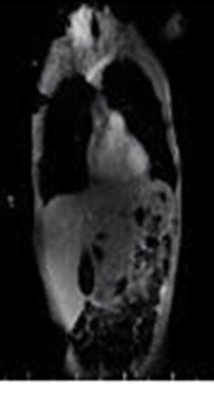 Southwest Journal Of Pulmonary Critical Care And Sleep Imaging