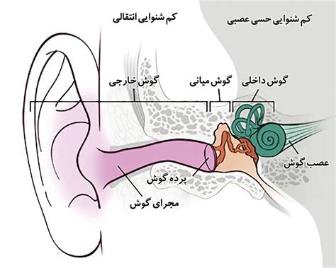 از کم شنوایی و ناشنوایی چه می‌دانیم؟ کلینیک سمعک ساعی
