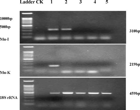 Rt Pcr Amplification Of Mu I 310 Bp Mu K 219 Bp And An Internal