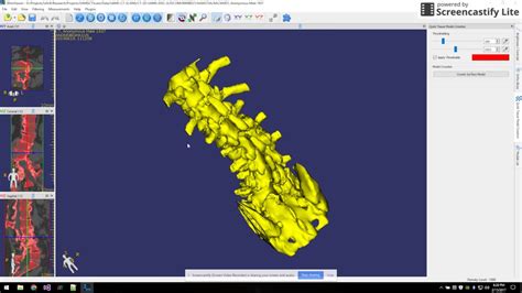 dicom processing youtube