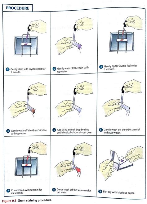 Gram Staining Procedure Microbiology Microbiology Lab Medical