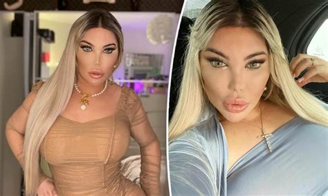 Keperawanannya Hilang Transgender Ini Kesakitan Hingga Kurung Diri