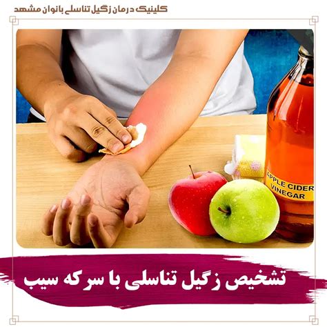 درمان زگیل تناسلی با سرکه سیب سرکه برای درمان و تشخیص زگیل تناسلی