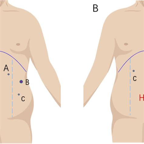 Port Positions For E Tep And Ipom Plus A Port Positions For E Tep