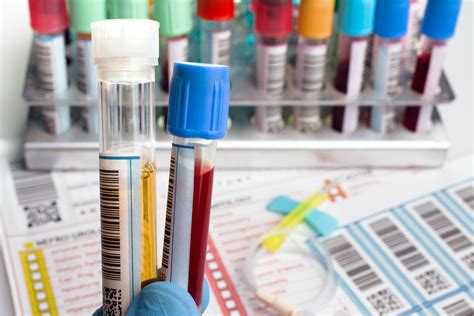 intro lab work with sex hormones functional medicine costa rica