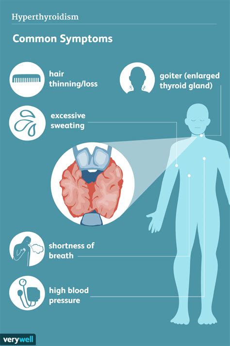 Hyperthyroidism Signs Symptoms And Complications
