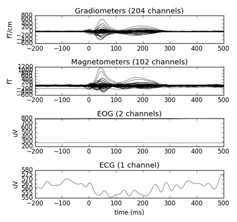 megsim experimental and simulation datasets — mne 0 14 1 documentation